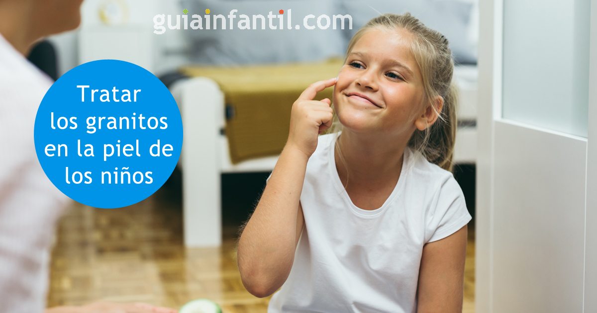 Cuidar la piel de niños con queratosis pilar o granitos en las mejillas Cuidar la piel de niños con queratosis pilar o granitos en las mejillas