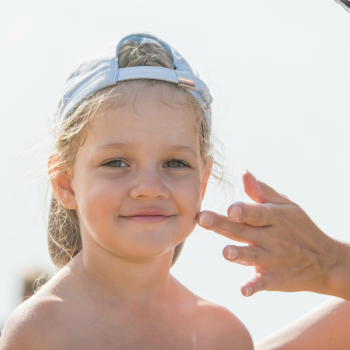 5 trucos para eliminar el acné en los niños